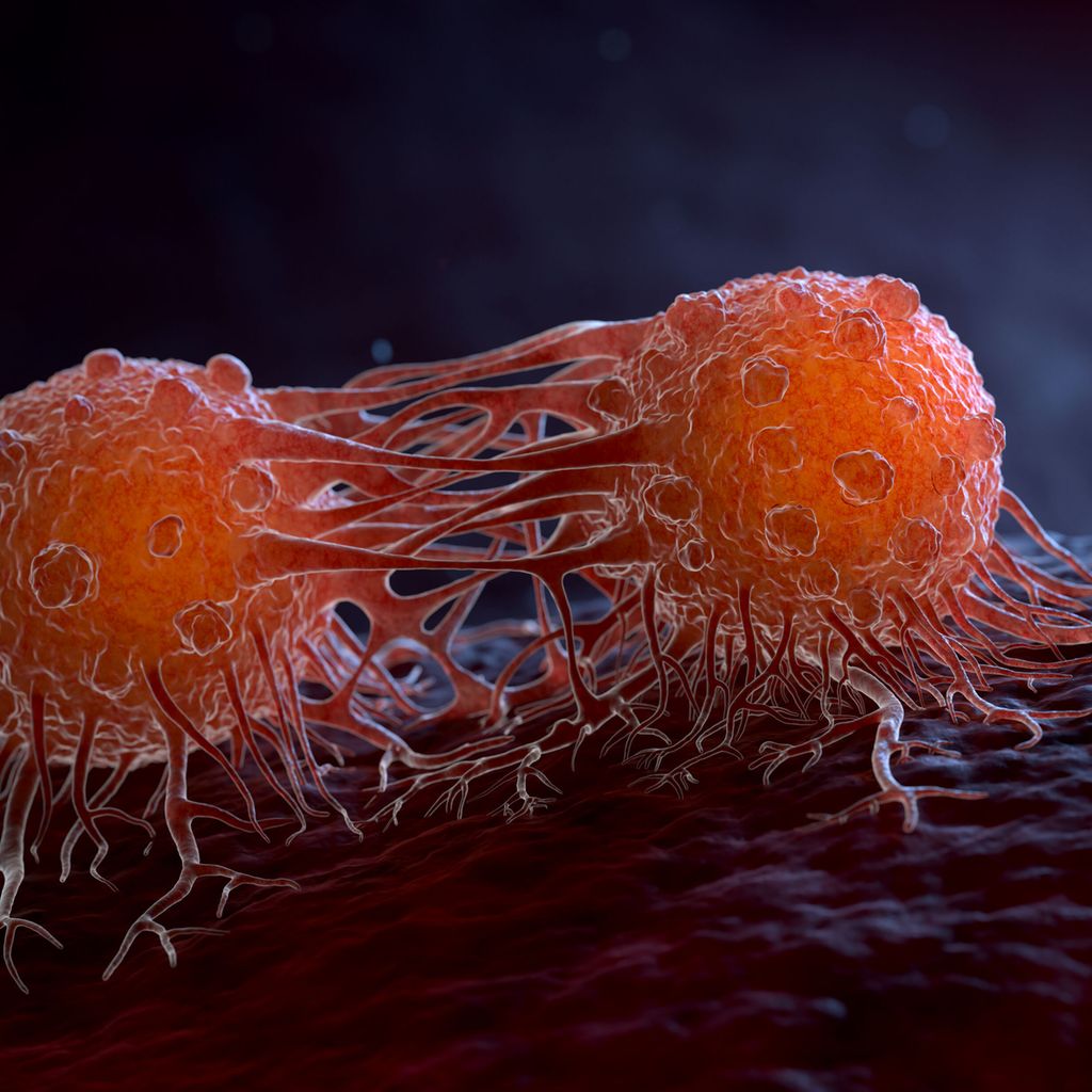 Gastrointestinale Tumoren: innovative Therapien verbessern Prognose ...